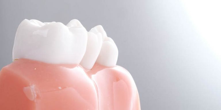 Backenzähne - So können die hinteren Zähne gepflegt werden